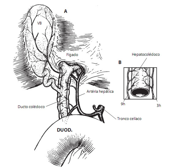 Figura 34.6. A. Irrigação dos ductos biliares extra-hepáticos. B ...