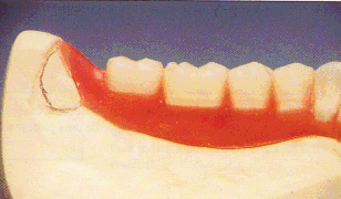 fig04-70